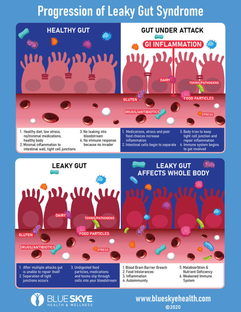 Tampa Integrative Medicine for Leaky Gut Syndrome